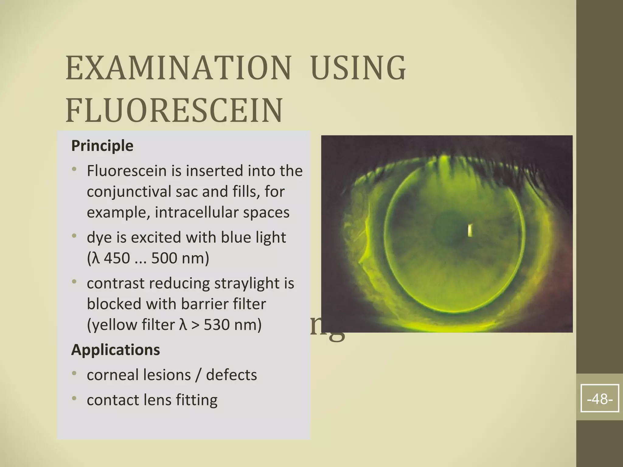 Slit lamp examination | PPT
