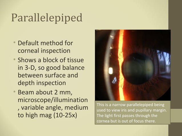 Slit lamp examination | PPT | Photography | Arts and Crafts