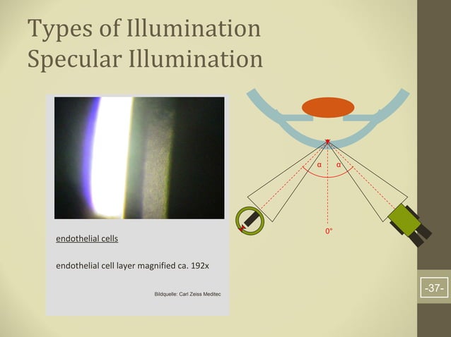Slit lamp examination | PPT | Photography | Arts and Crafts