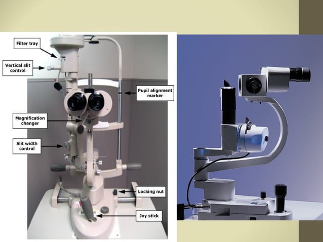 Slit lamp examination | PPT | Photography | Arts and Crafts