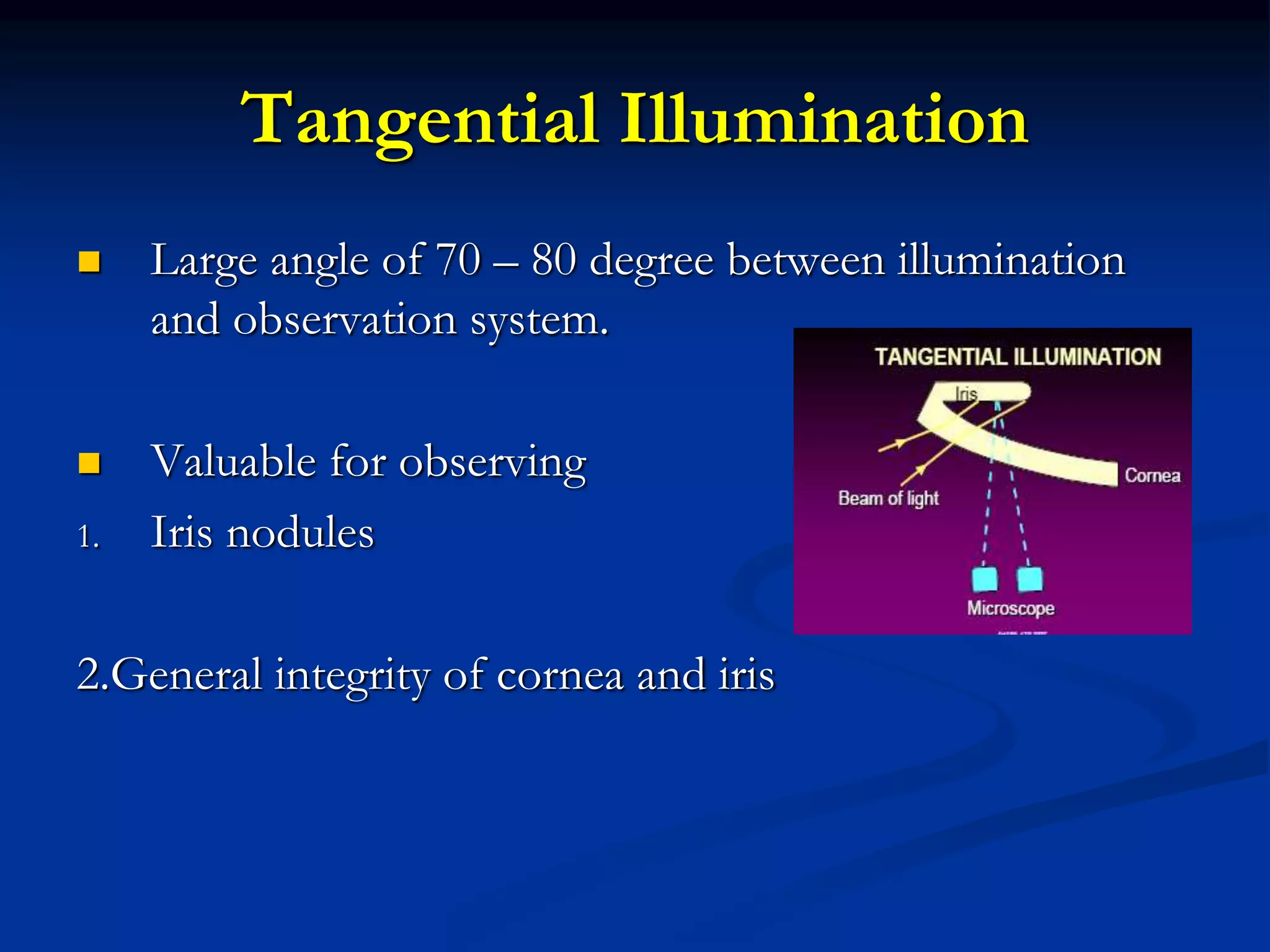 Slit lamp examination.ppt