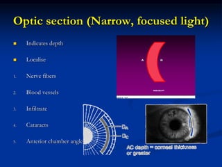 Slit lamp examination.ppt
