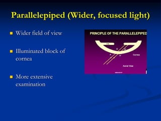 Slit lamp examination.ppt