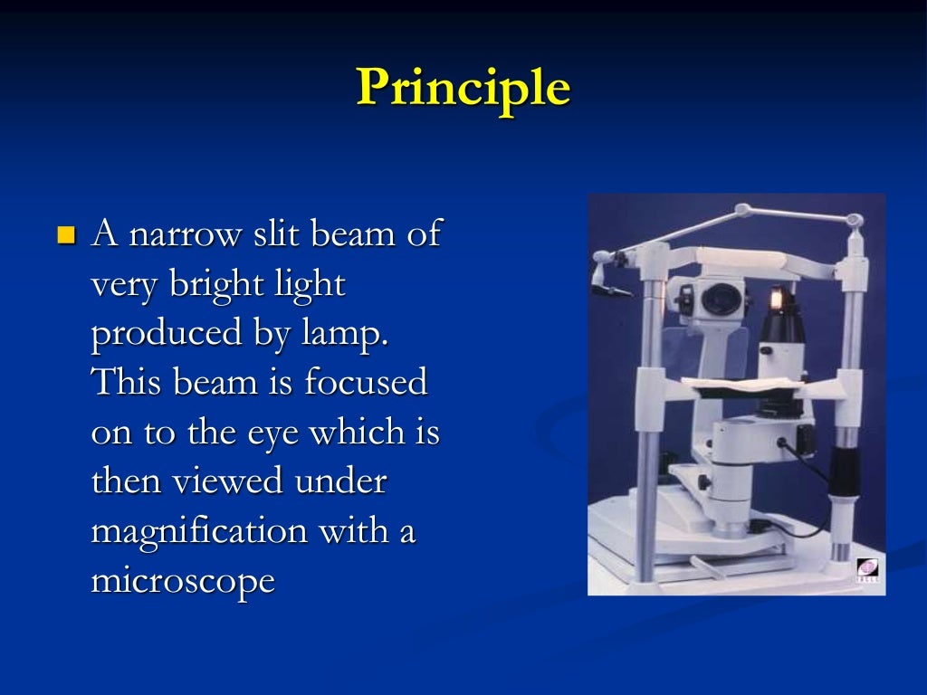 Slit lamp examination.ppt