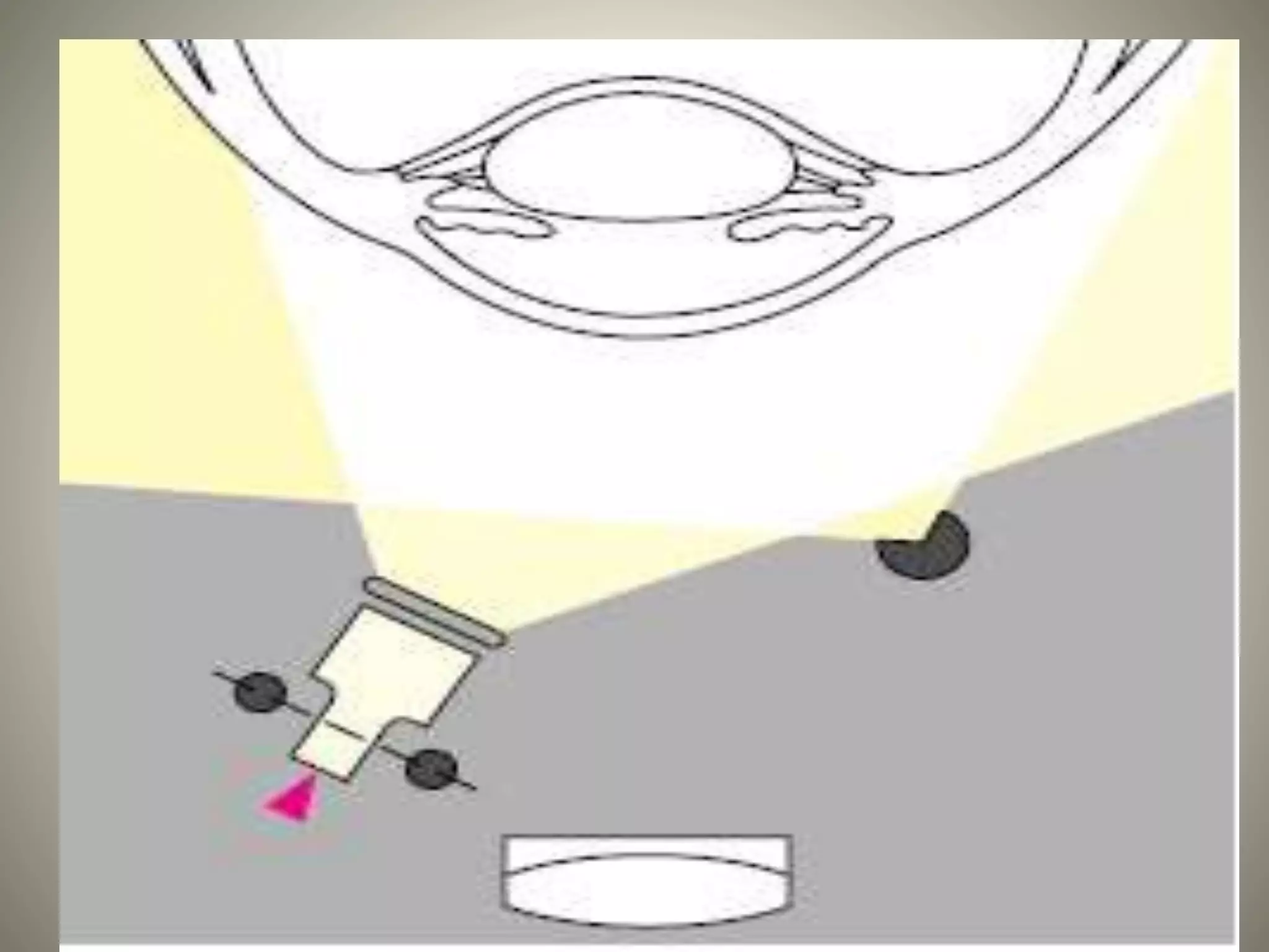 Slit lamp examination lecture | PPTX