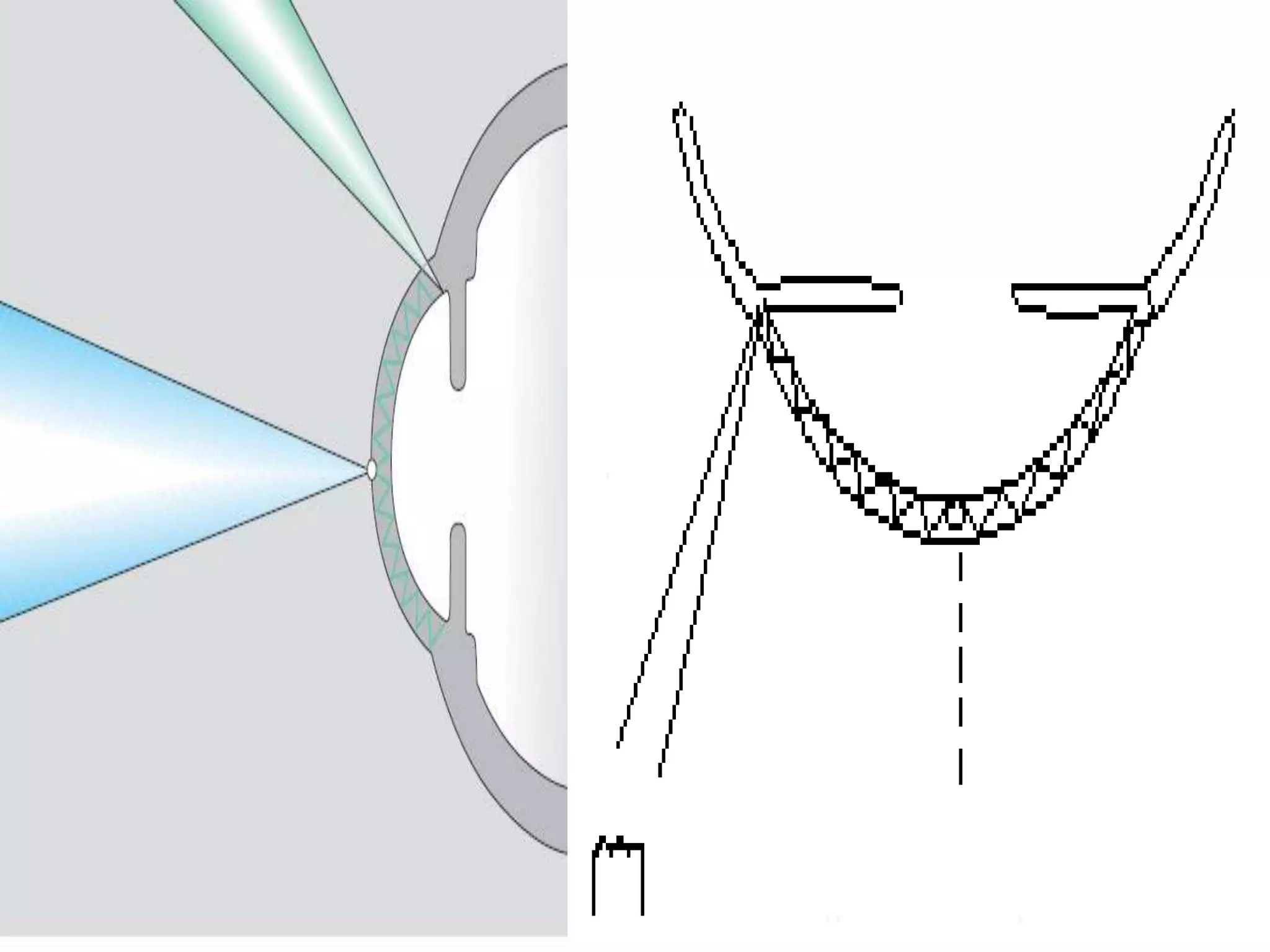 Slit lamp examination lecture | PPTX