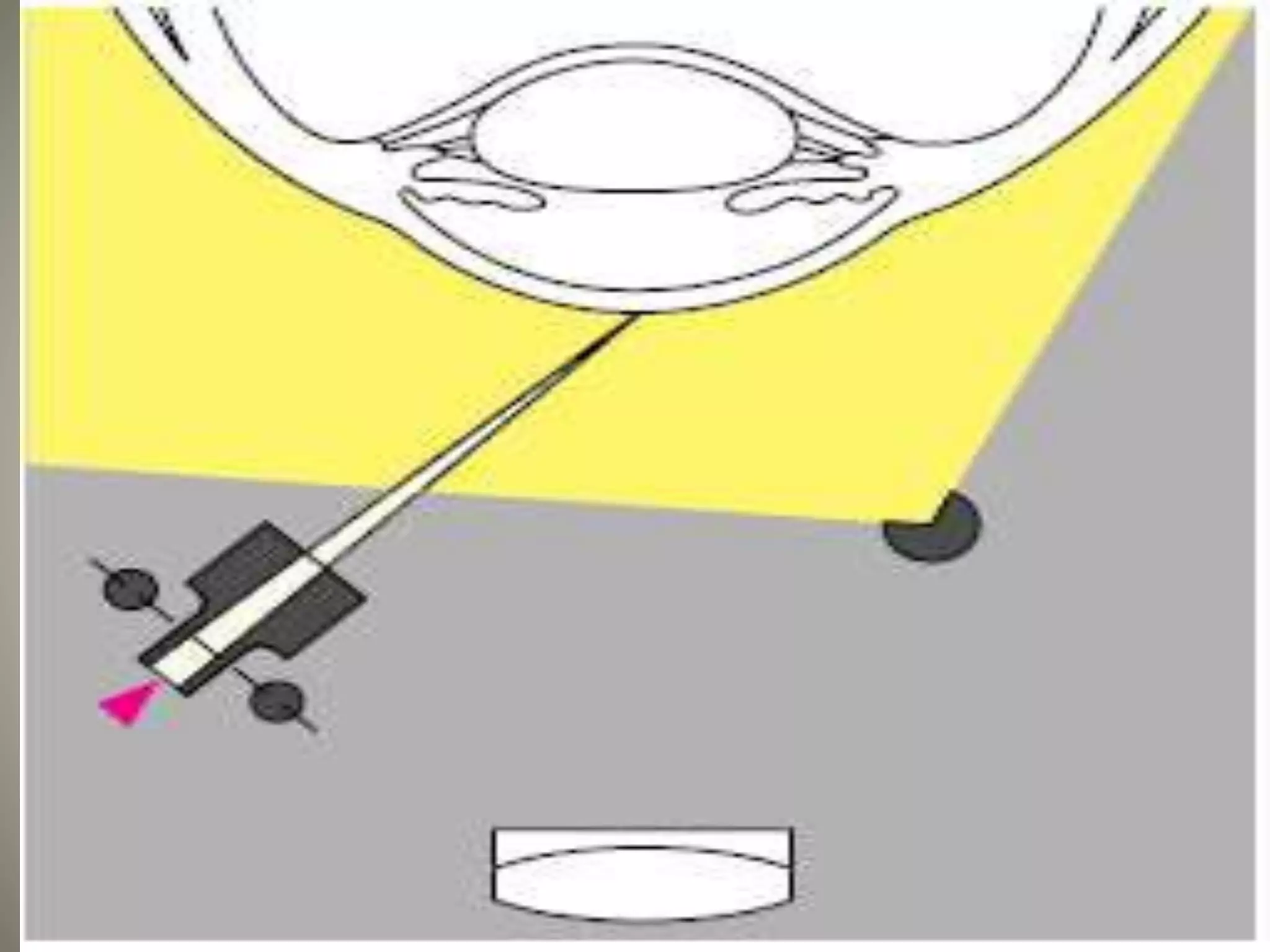 Slit lamp examination lecture | PPTX