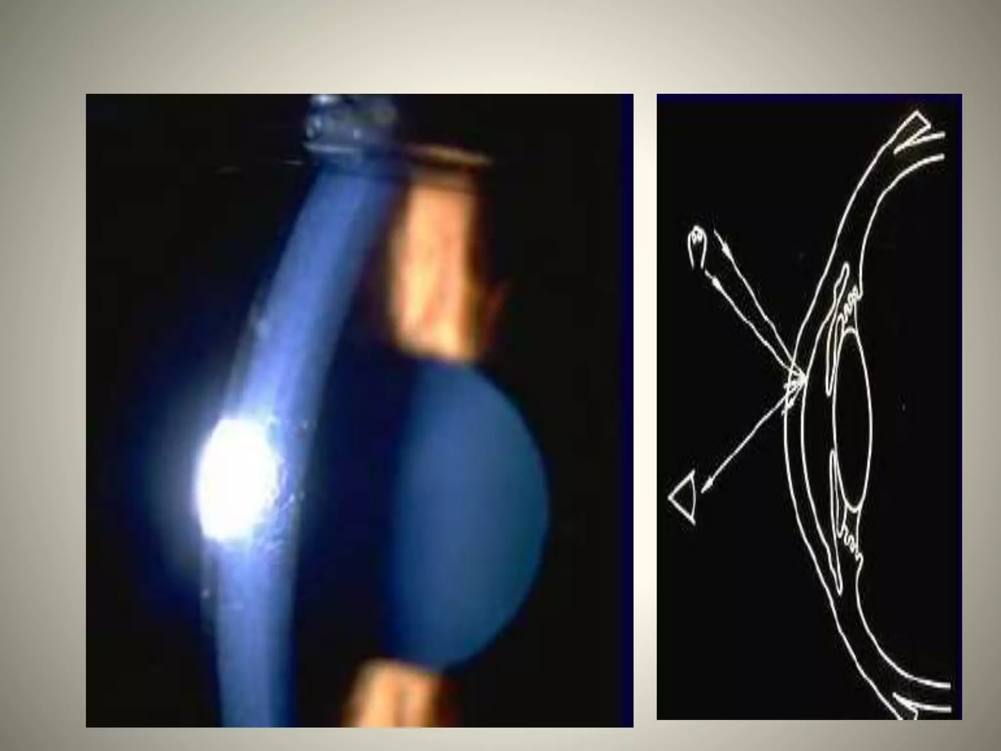 Slit lamp examination lecture | PPTX