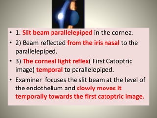 Corneal Parallelepiped