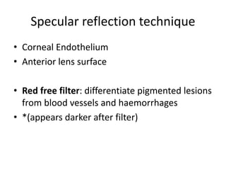 slitlamp examinations of Anterior Chamber.pptx