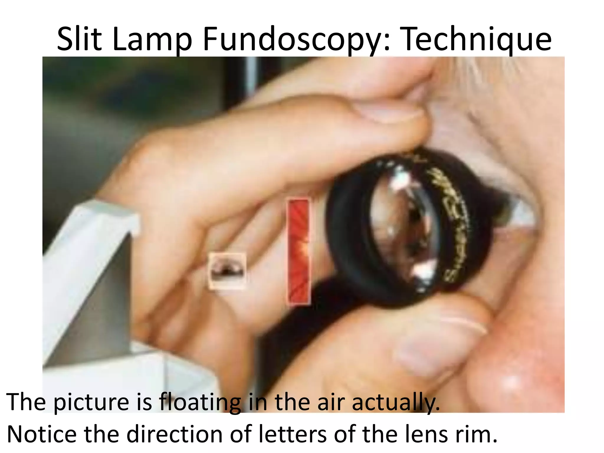 Slit lamp fundoscopy | PPTX