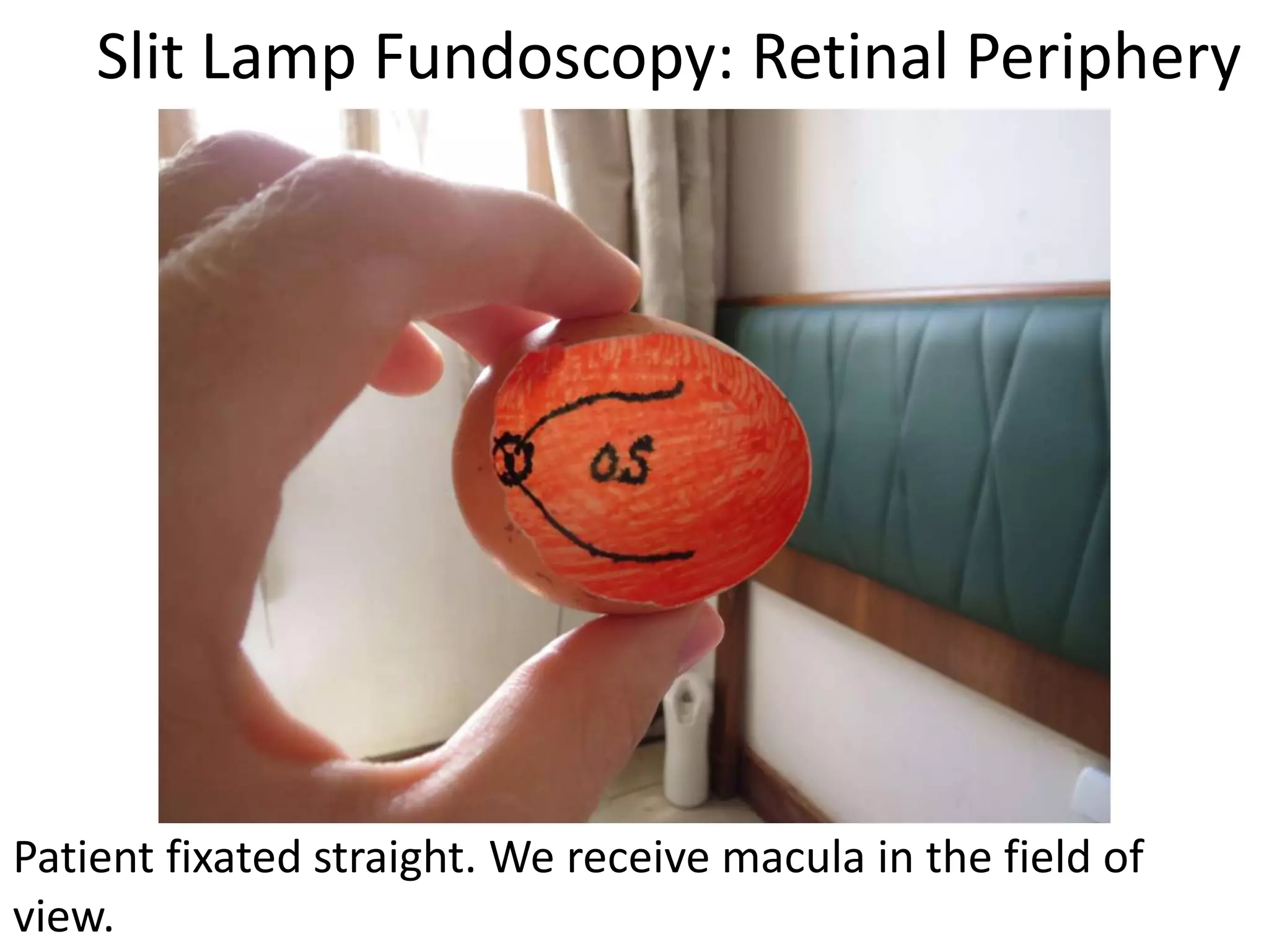 Slit lamp fundoscopy | PPTX