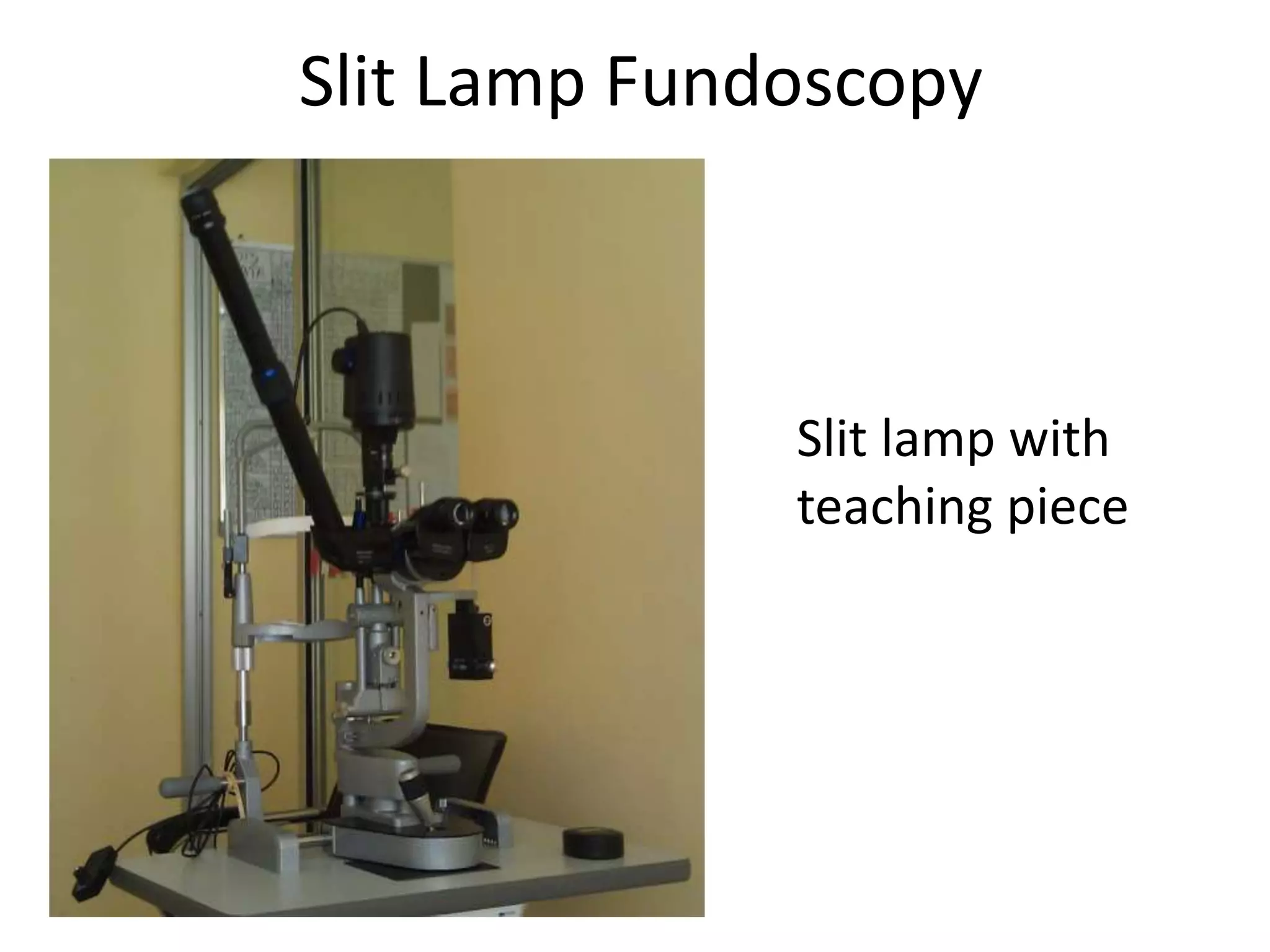 Slit lamp fundoscopy | PPTX