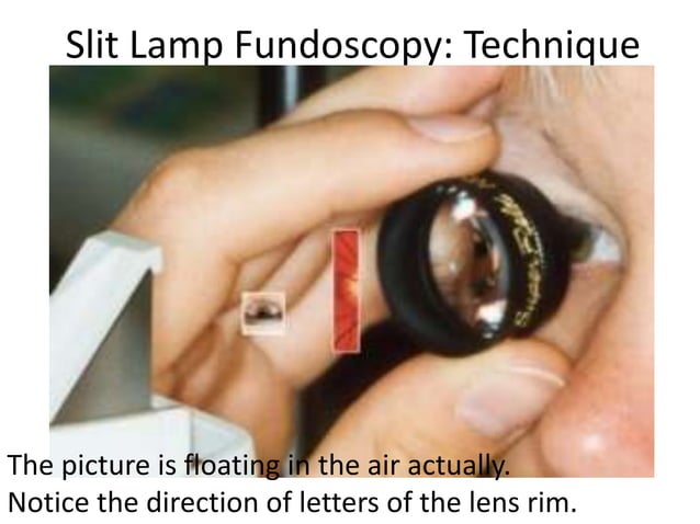 Slit lamp fundoscopy | PPTX | First Aid | Injuries