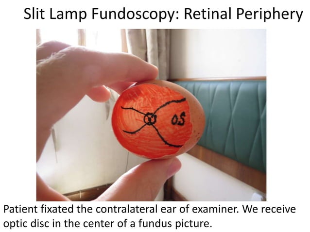 Slit lamp fundoscopy | PPTX | First Aid | Injuries