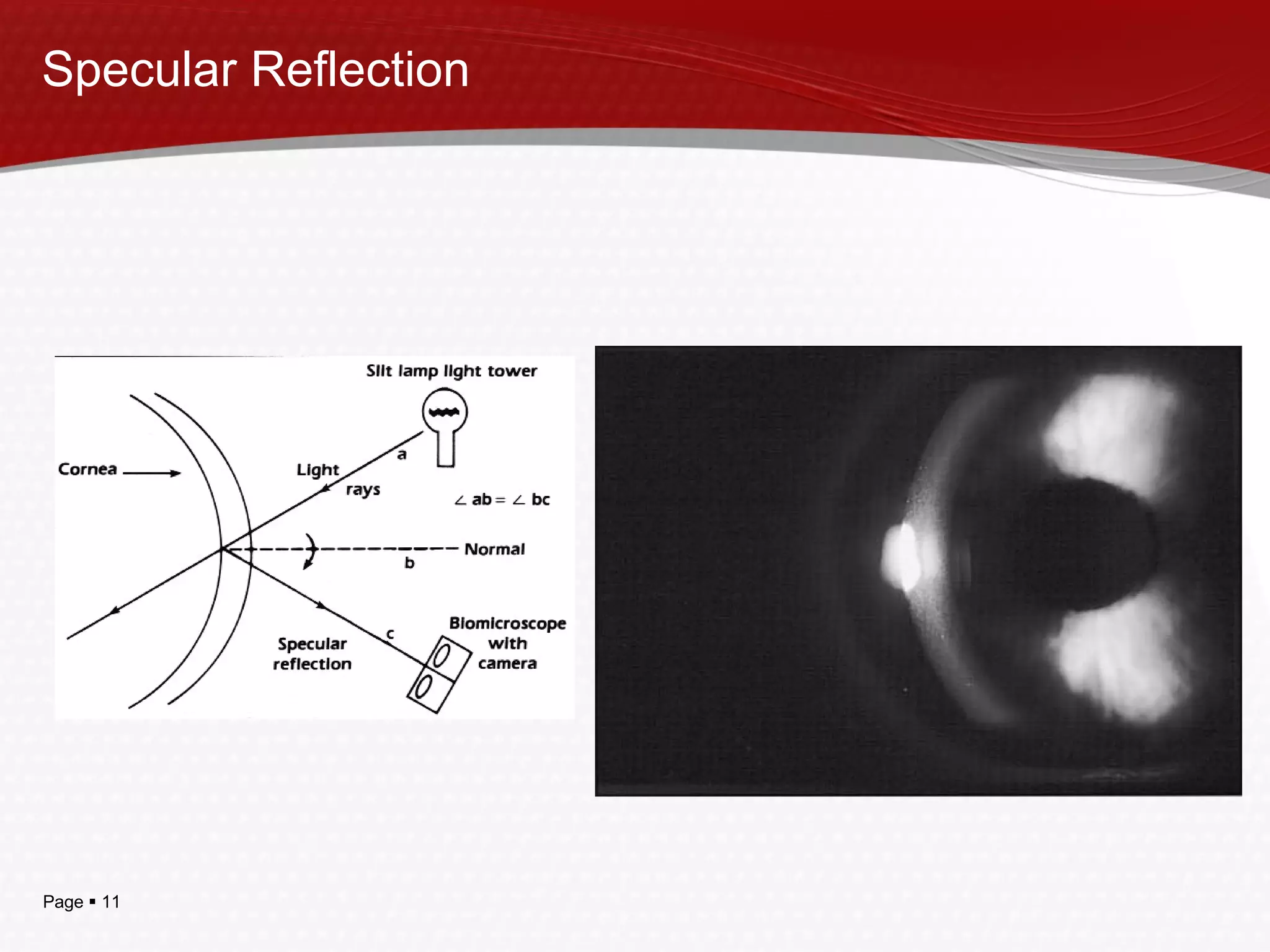 Slit Lamp Illumination Techniques | PPT