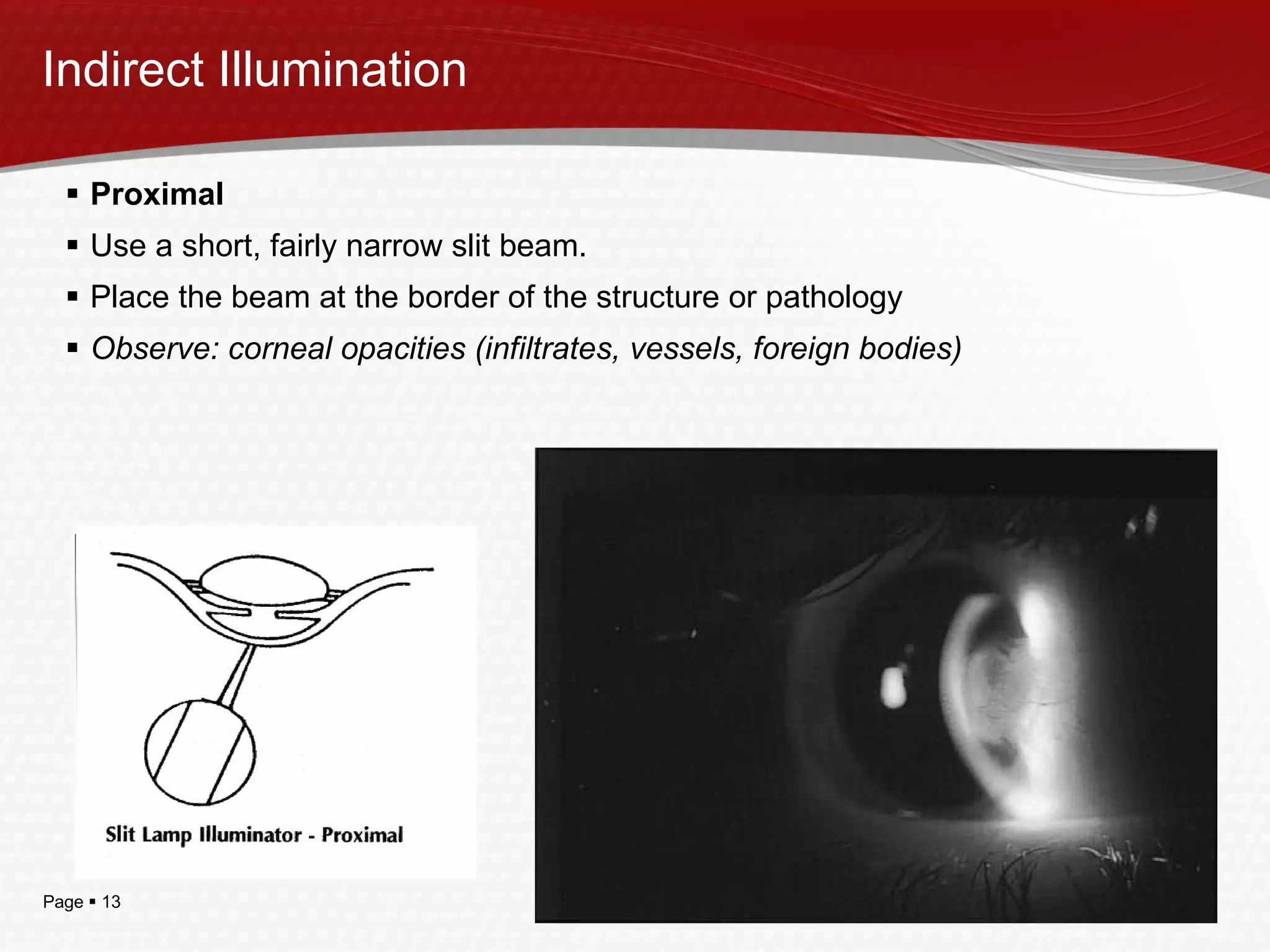 Slit Lamp Illumination Techniques | PPT