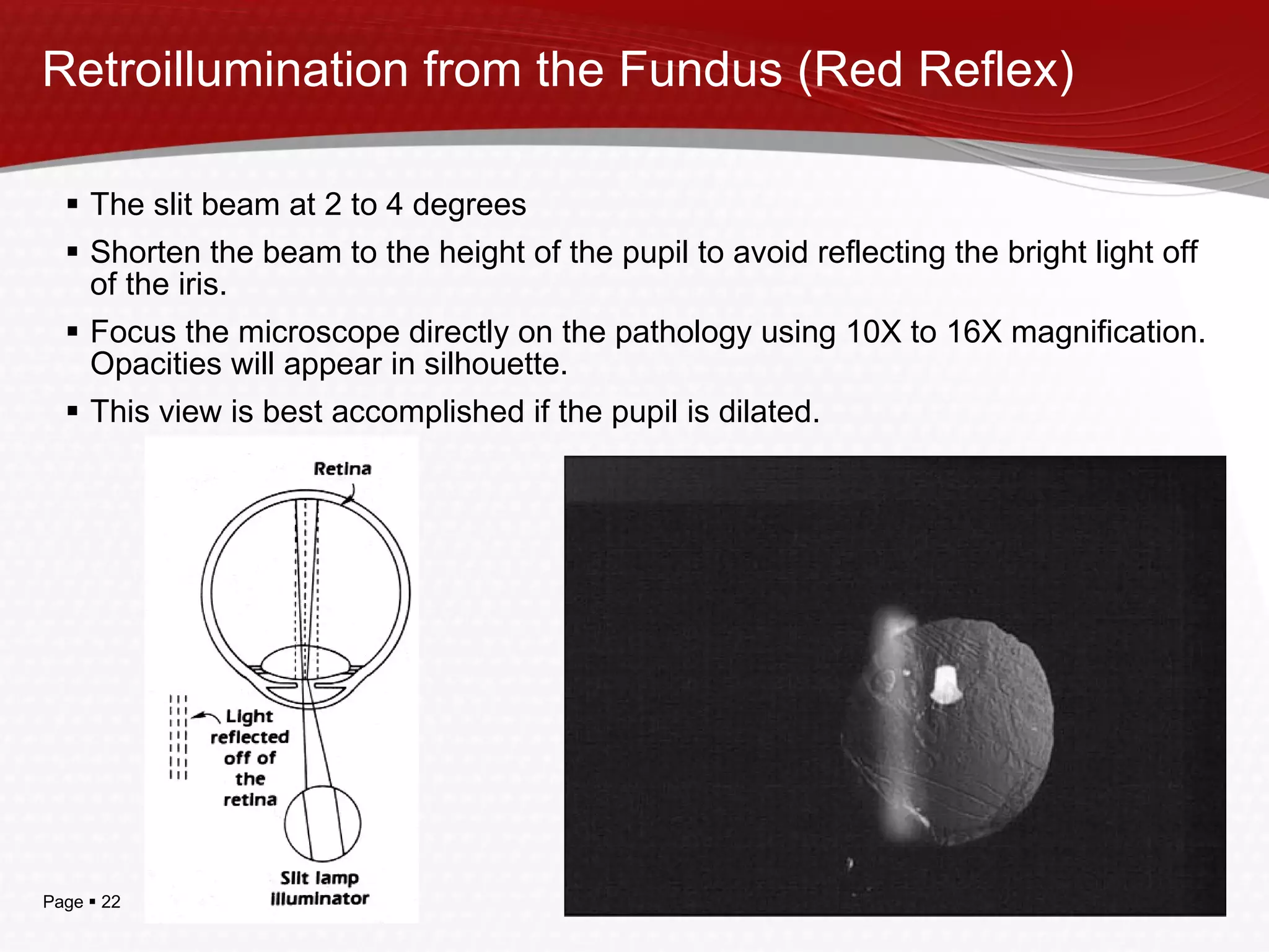 Slit Lamp Illumination Techniques | PPT