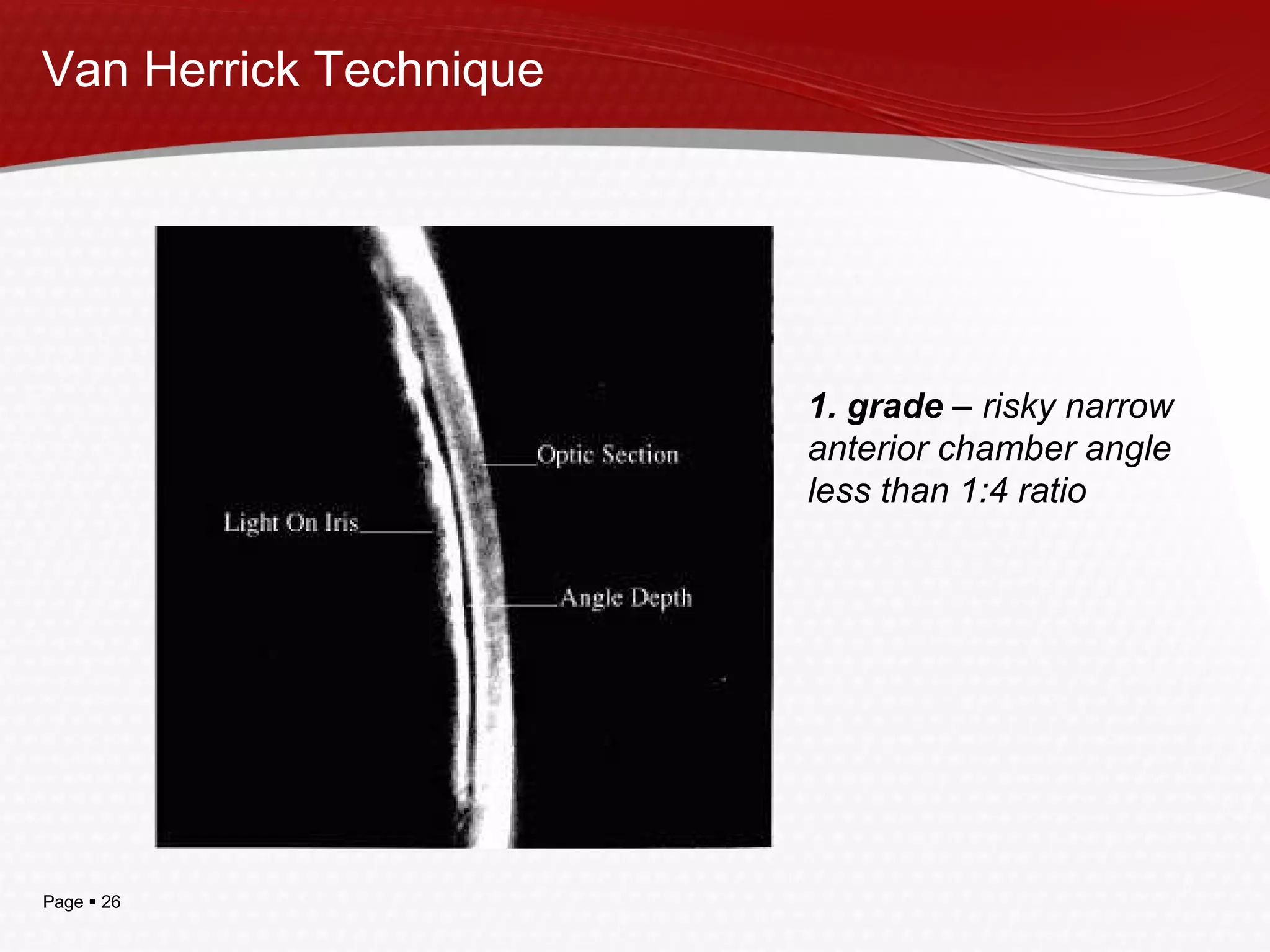 Slit Lamp Illumination Techniques | PPT