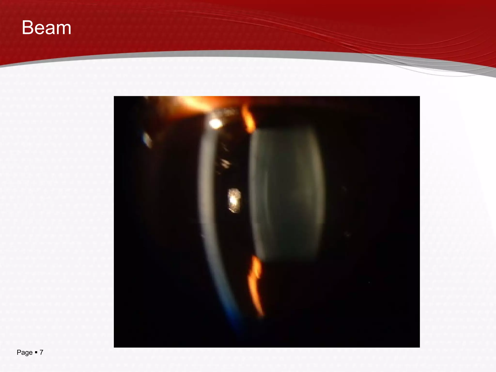 Slit Lamp Illumination Techniques | PPT