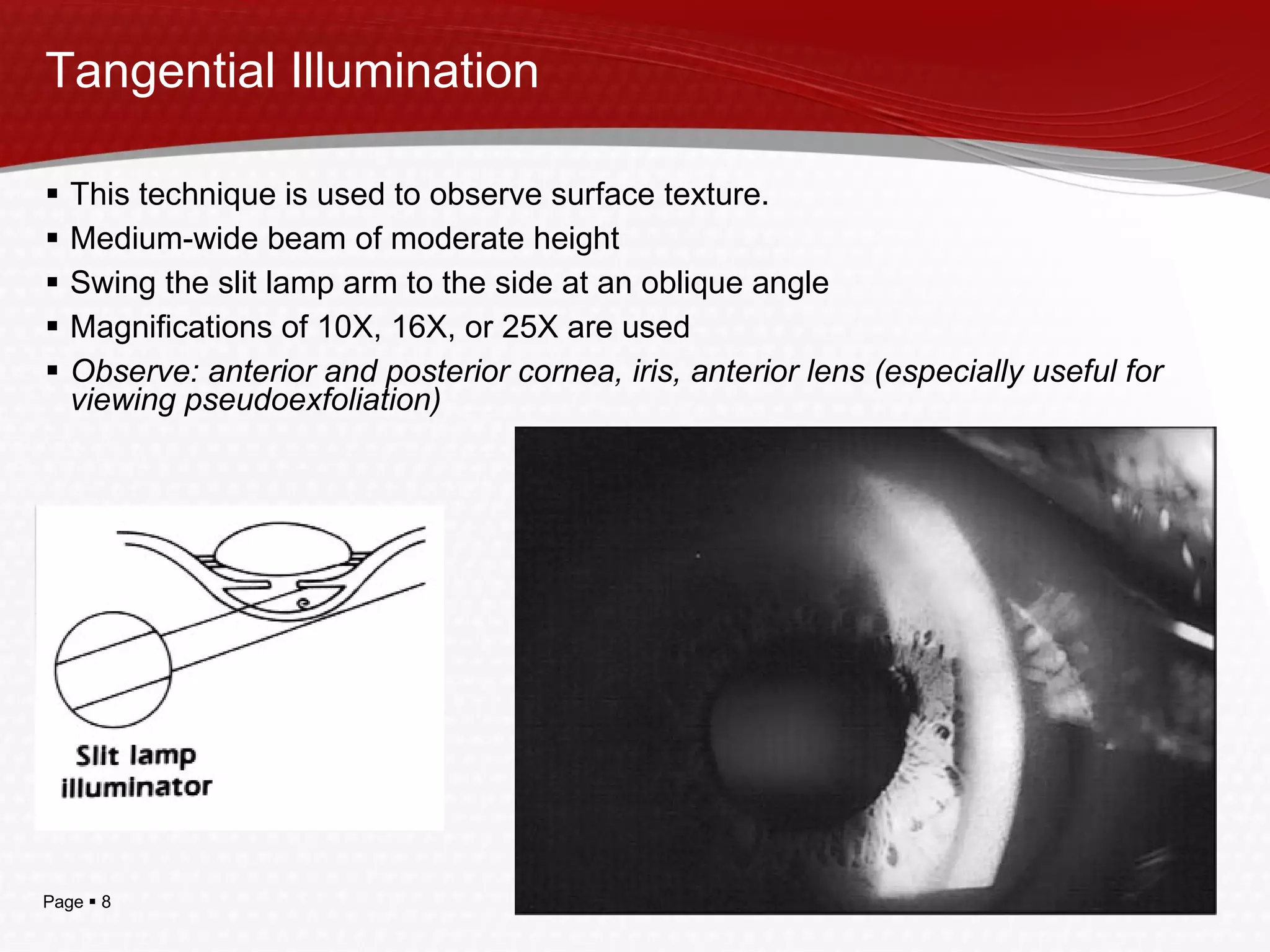 Slit Lamp Illumination Techniques | PPT