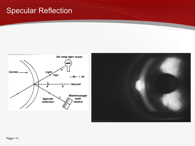 Slit Lamp Illumination Techniques | PPT | Eye and Vision Conditions ...
