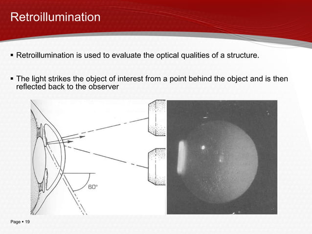 Slit Lamp Illumination Techniques | PPT | Eye and Vision Conditions ...