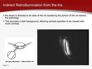 Slit Lamp Illumination Techniques | PPT