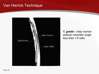 Slit Lamp Illumination Techniques | PPT