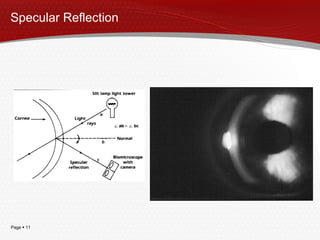 Specular Reflection Slit Lamp Technique