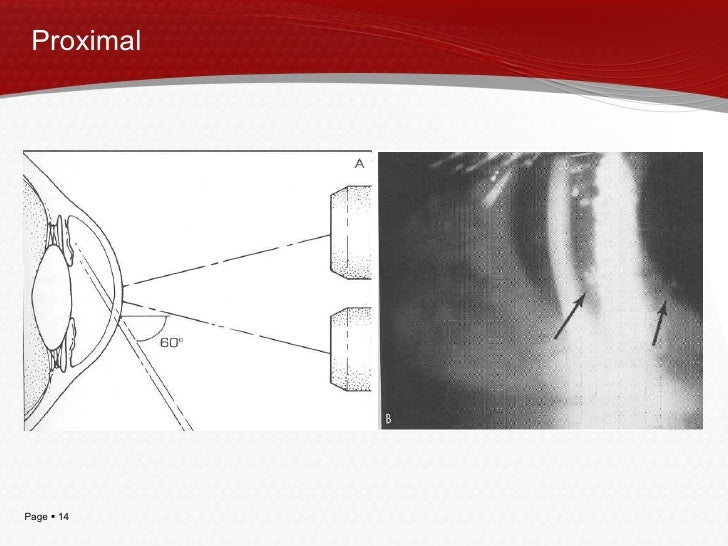 Slit Lamp Illumination Techniques