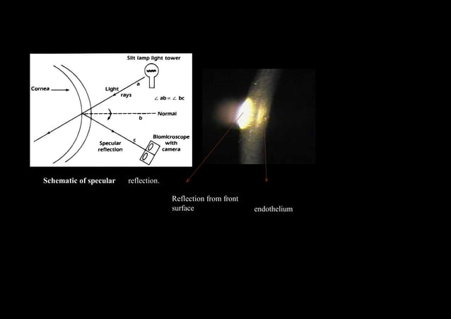 slit lamp examination n methods of illumination | PPT