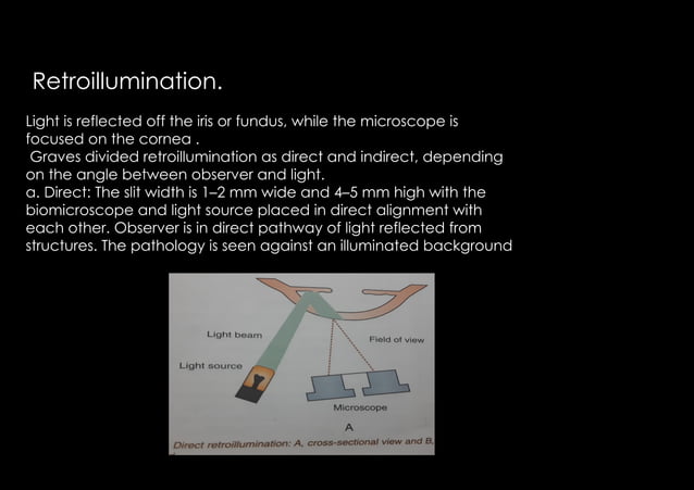 slit lamp examination n methods of illumination | PPT