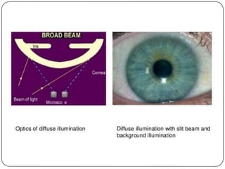slit lamp photography.pdf