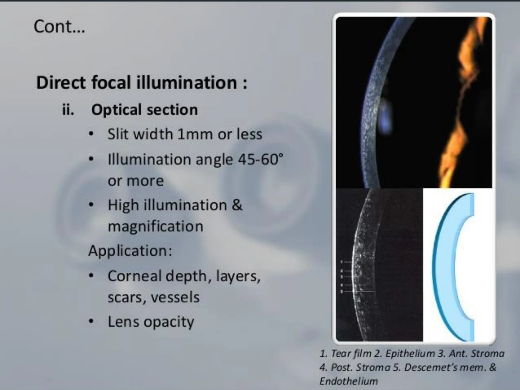 THE SLIT LAMP BIOMICROSCOPE PRESENTATION | PDF