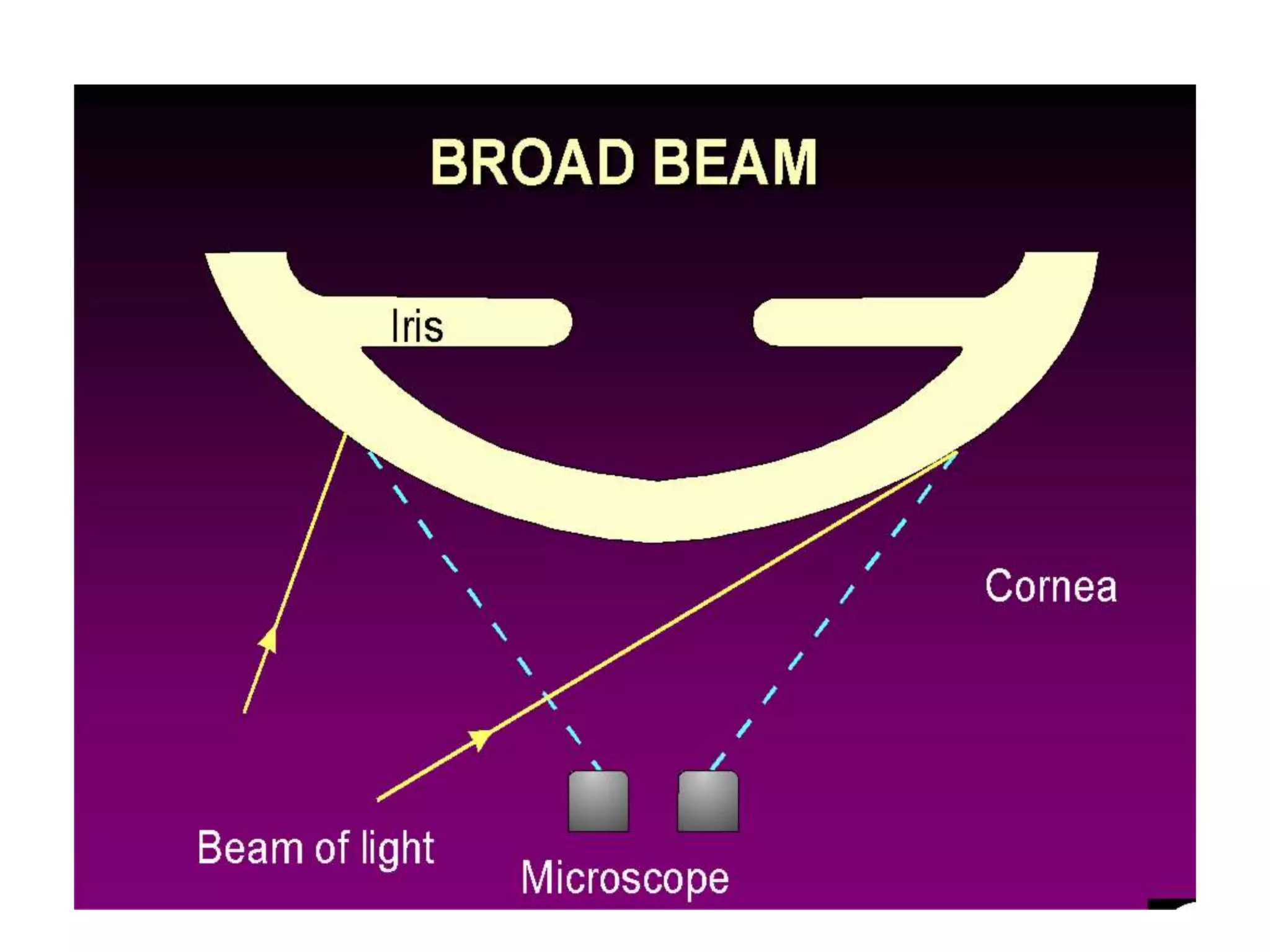 Slit lamp techniques.pptx