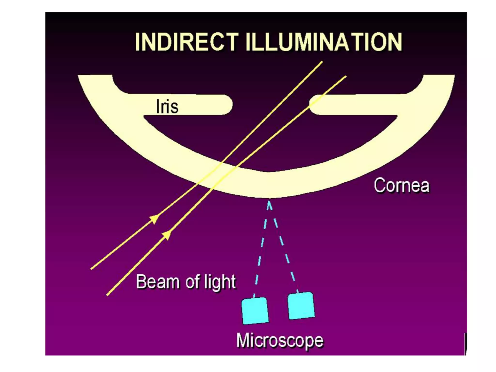 Slit lamp techniques.pptx
