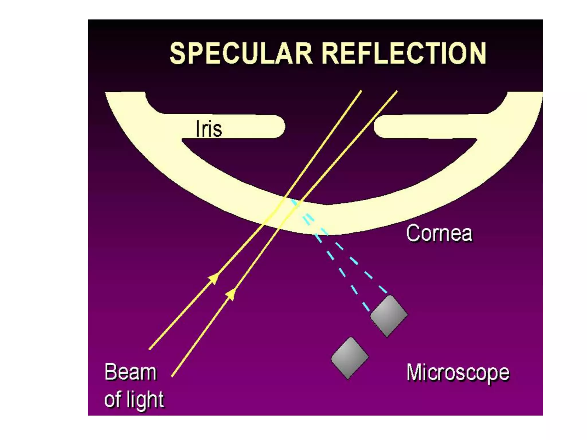 Slit lamp techniques.pptx