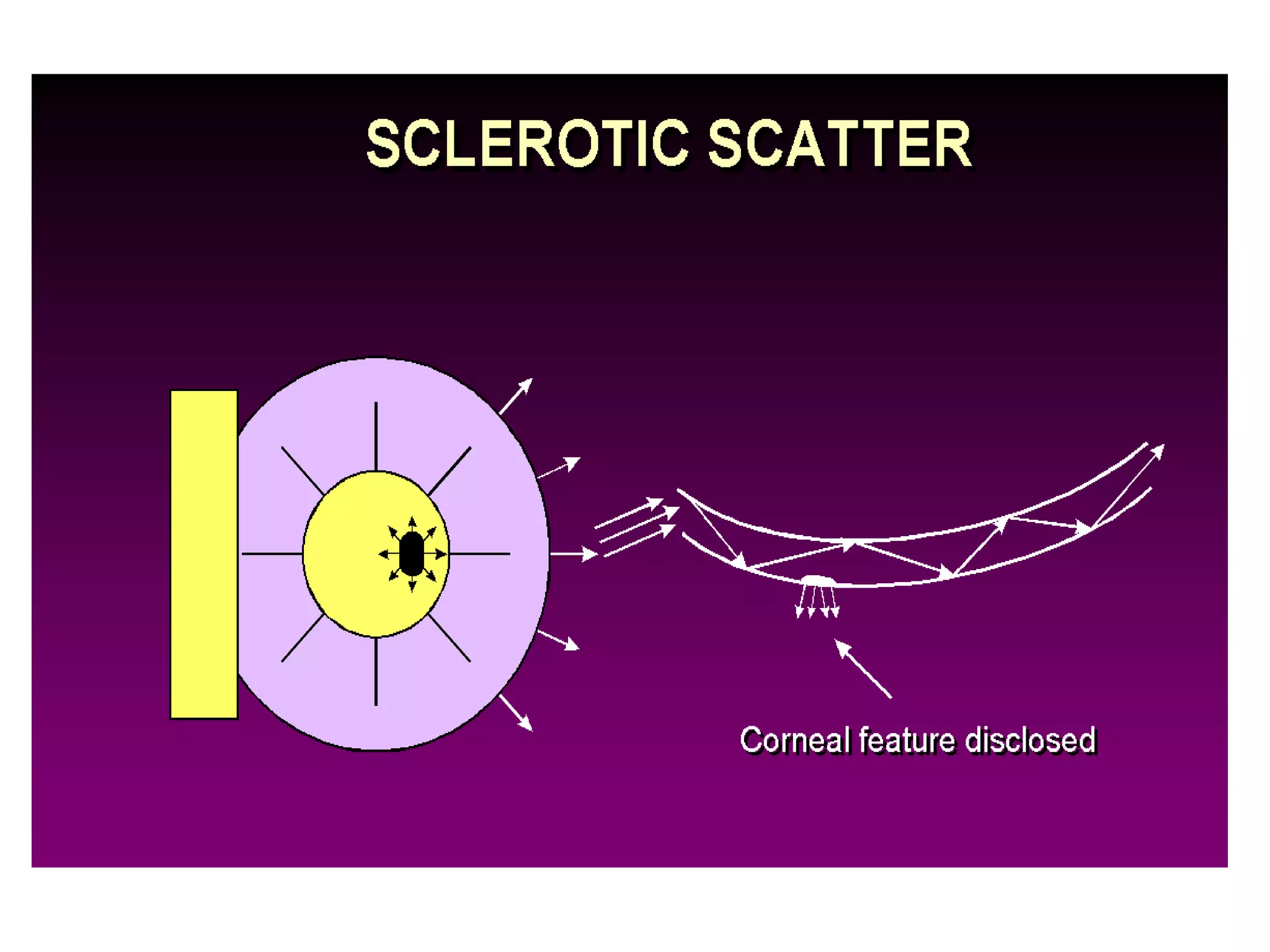 Slit lamp techniques.pptx
