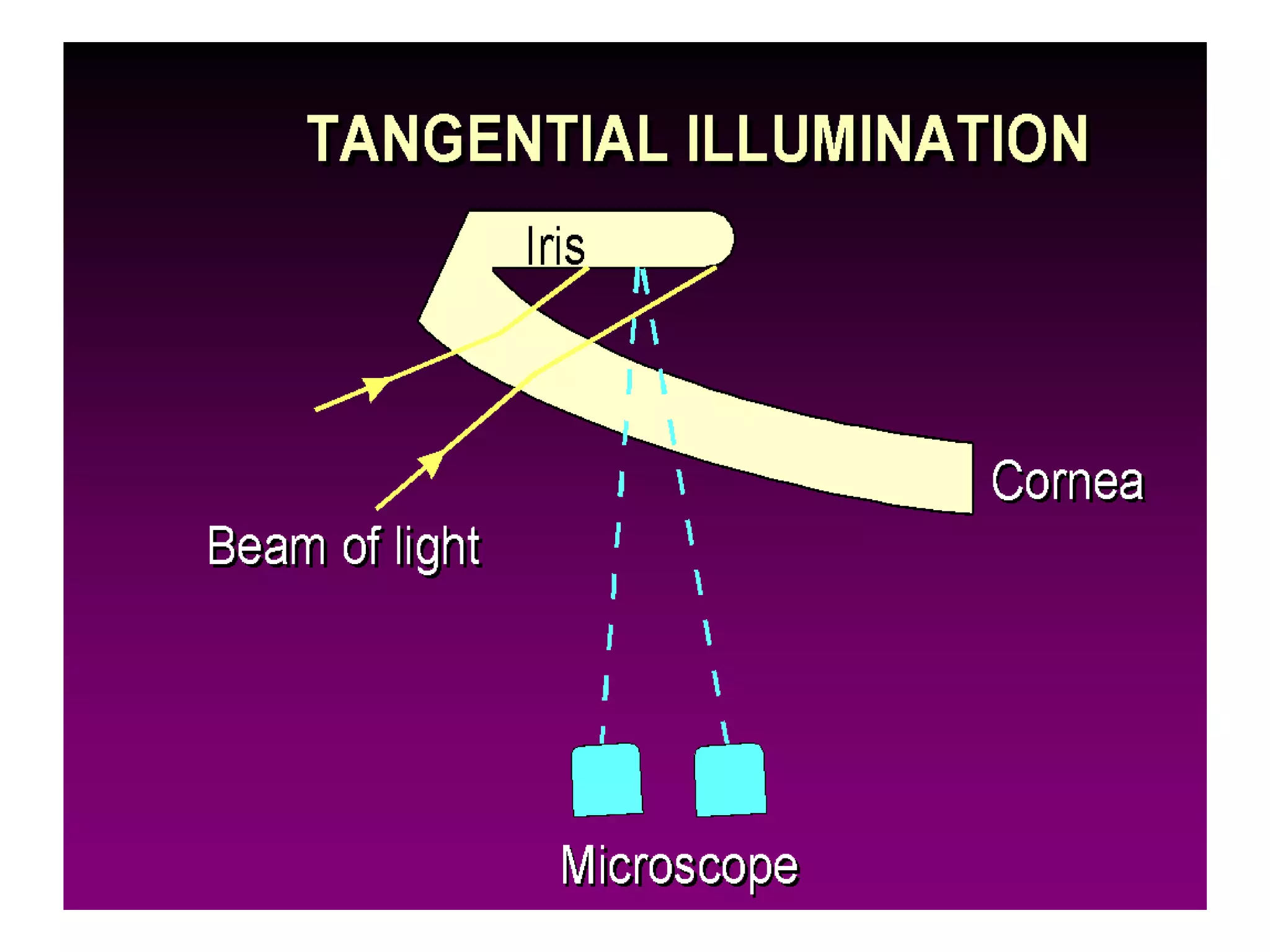 Slit lamp techniques.pptx