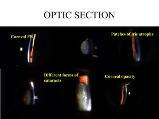 Slit lamp techniques.pptx