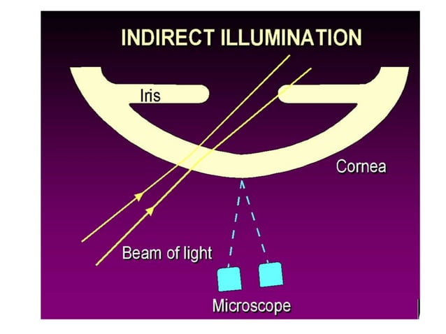 Slit lamp techniques.pptx