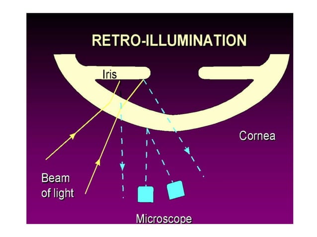 Slit lamp techniques.pptx