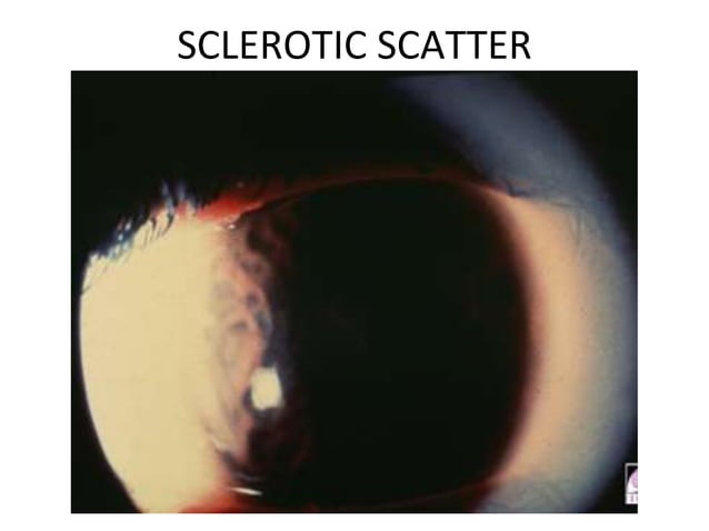 Slit lamp techniques.pptx