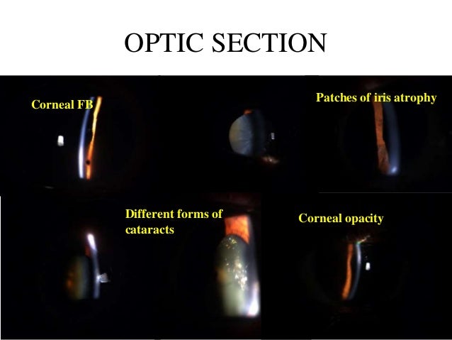 Slit lamp techniques.pptx