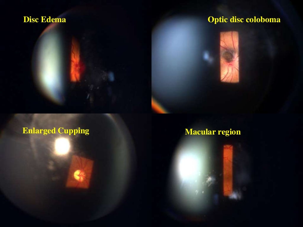 Slit lamp techniques.pptx