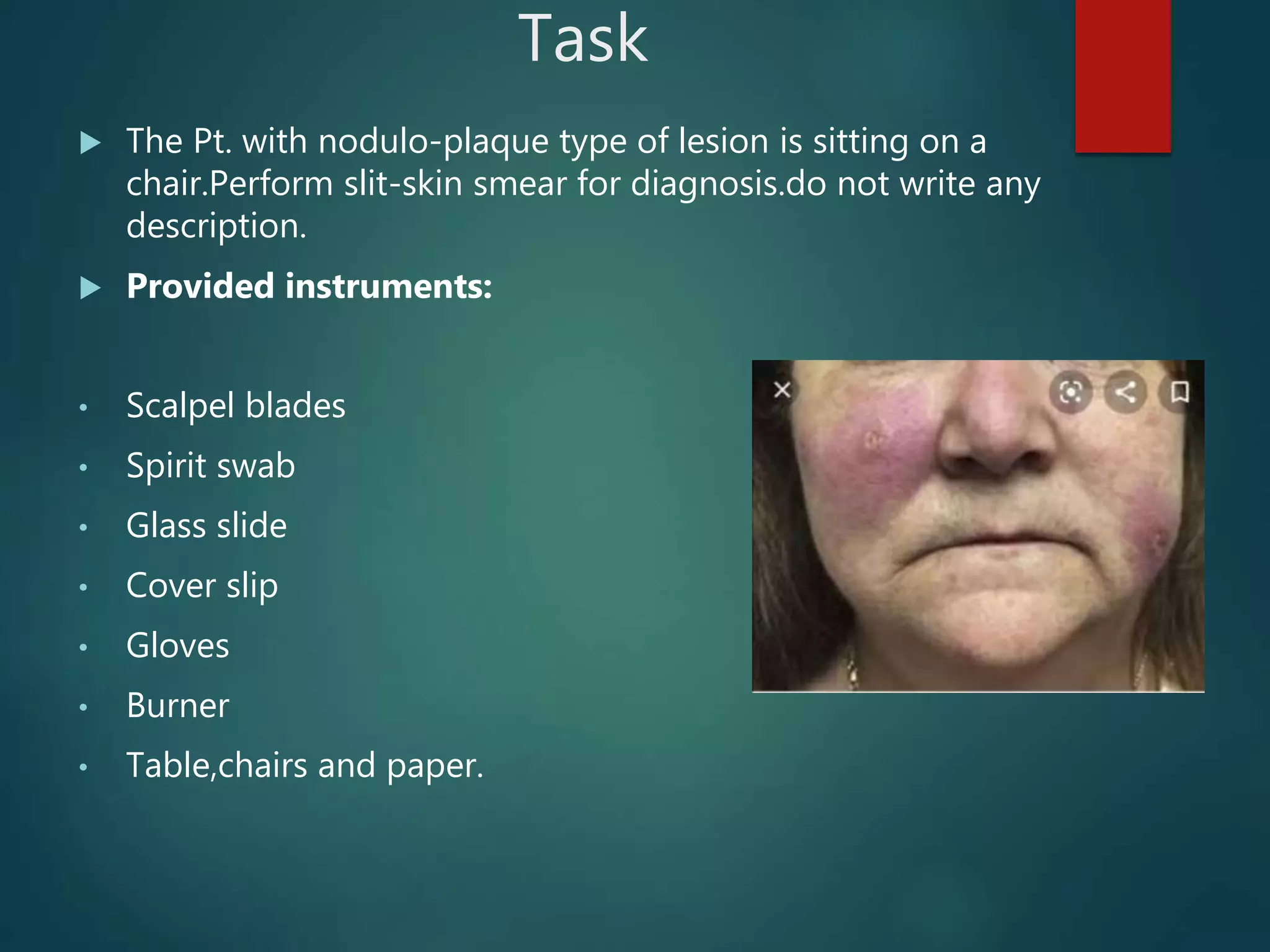 Slit skin smears | PPTX