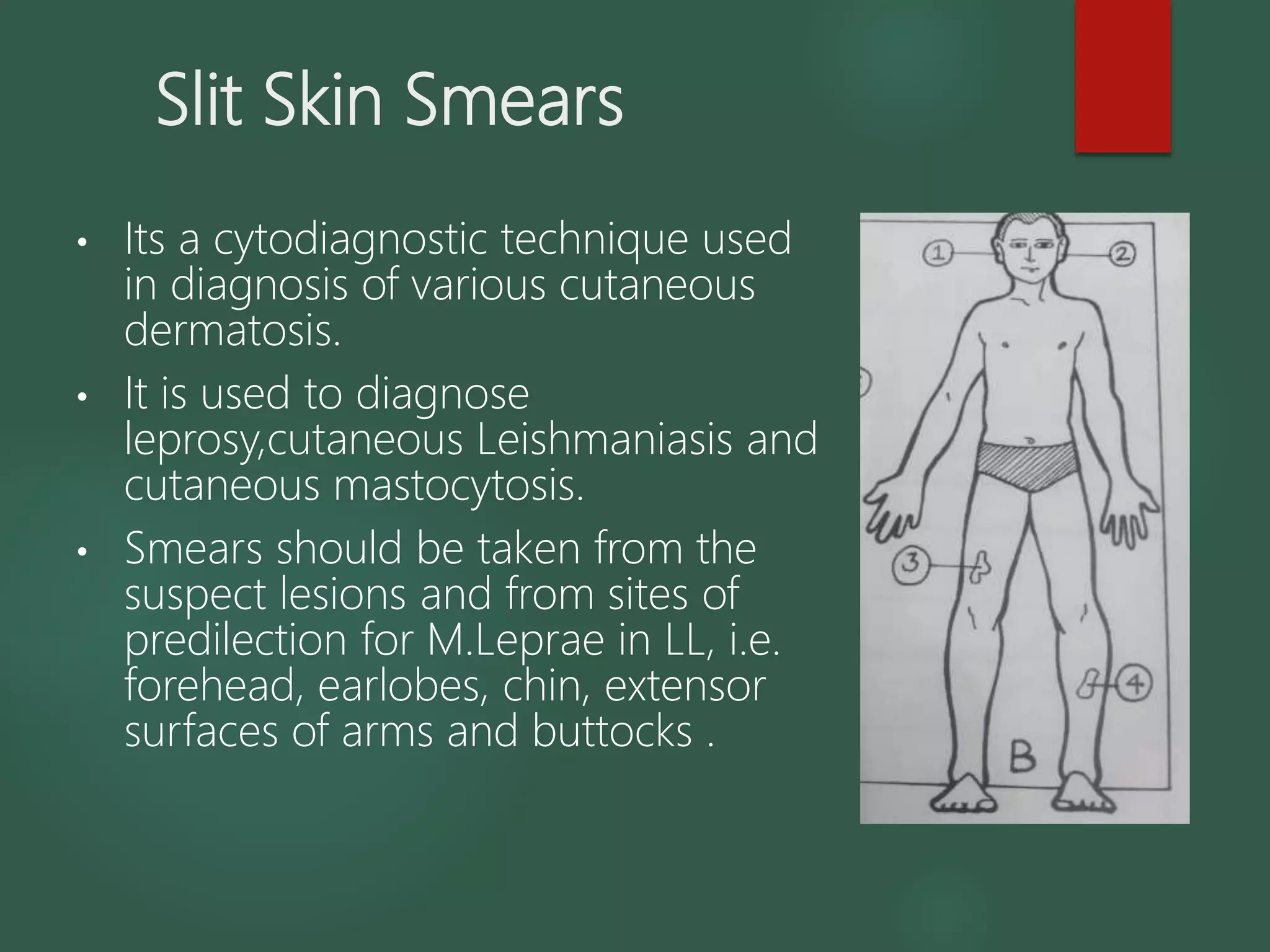 Slit skin smears | PPTX