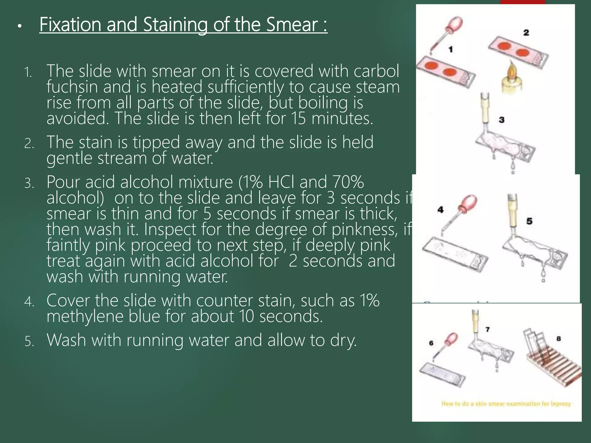 Slit skin smears | PPTX
