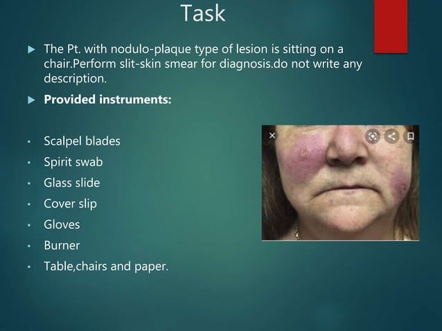 Slit skin smears | PPTX | Skin and Dermatology | Diseases and Conditions